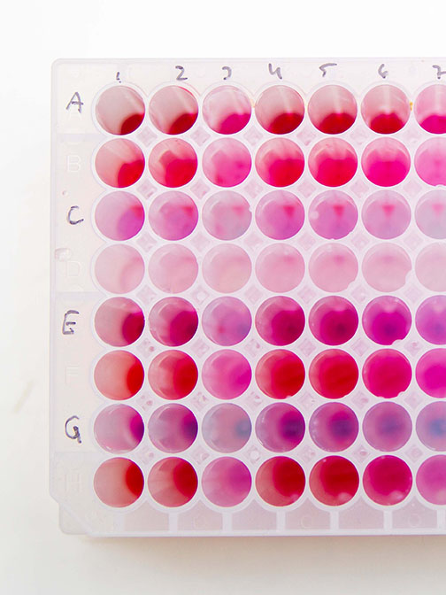 AAV Total Antibody (TAb) Assessment