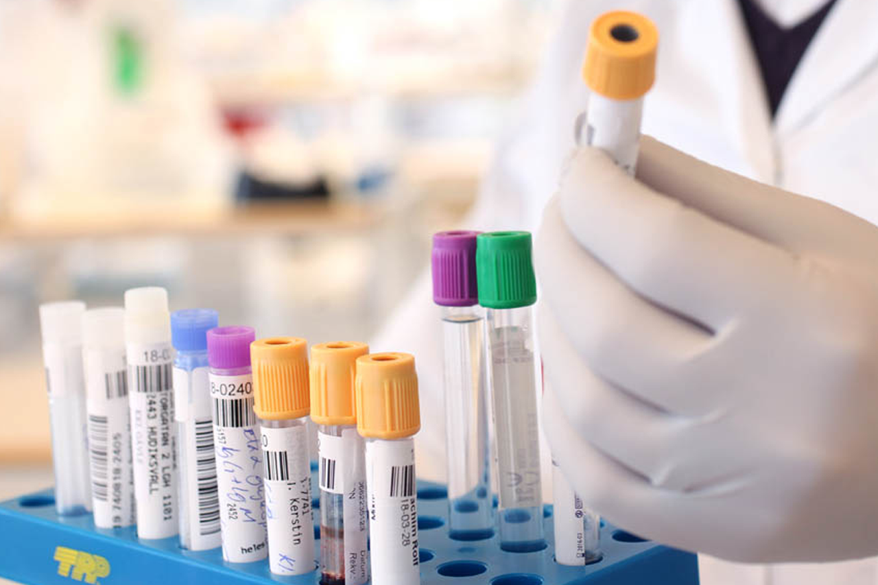 What Is A Diagnostic Lab Test at James Silvers blog
